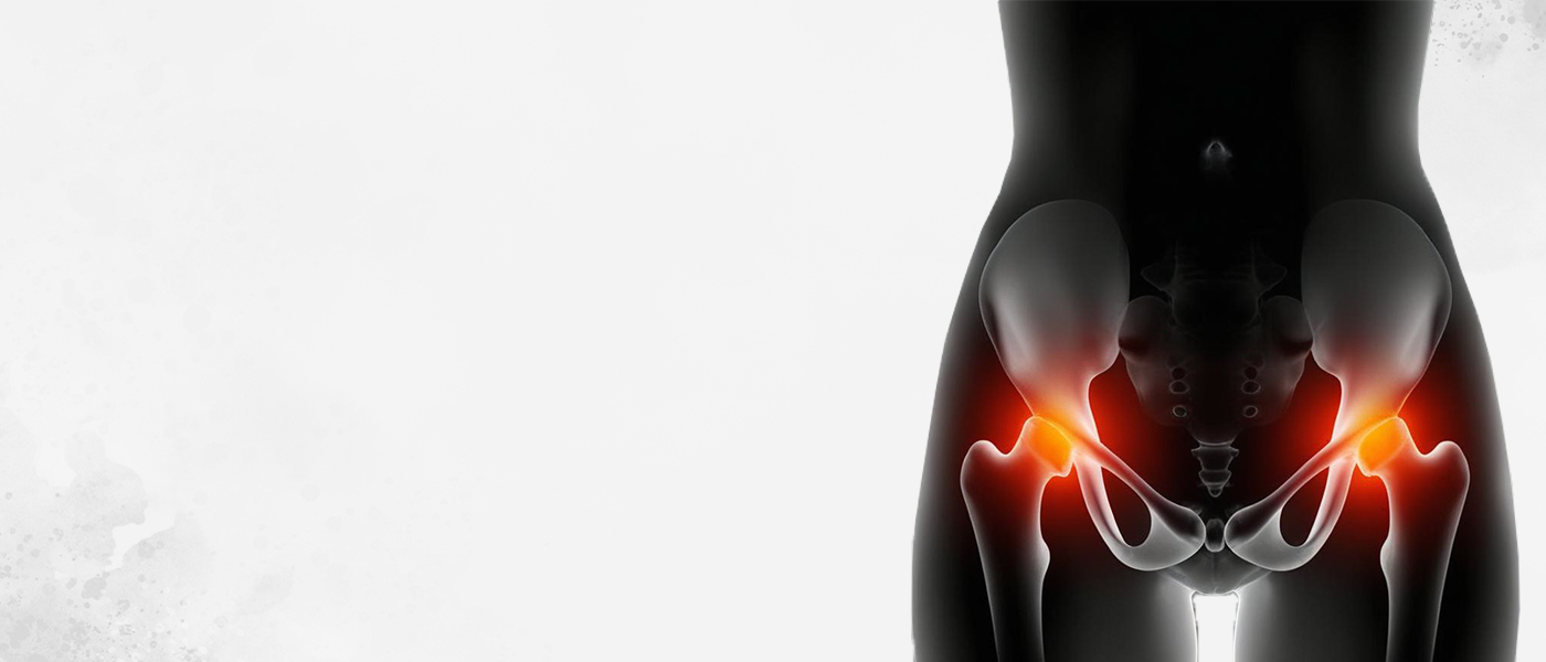 Avascular necrosis - StemRx Hospital and Research Centre